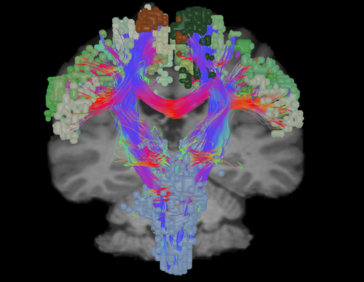 Board-certified Brain Surgeon | Best Neurosurgeon in San Antonio, Tx